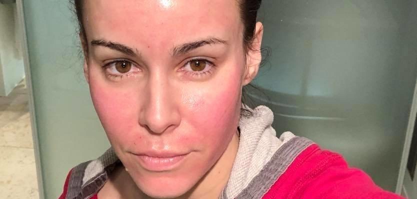 "Vampire-Facial" für Model Kerstin Lechner - Szene | heute.at