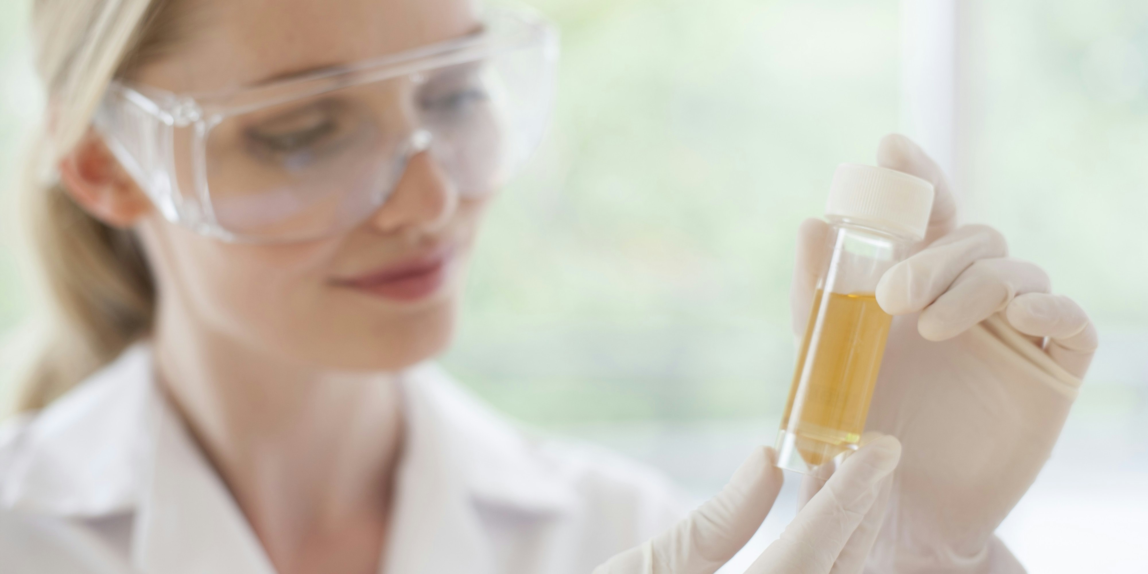 (Symbolbild) | Heute.at