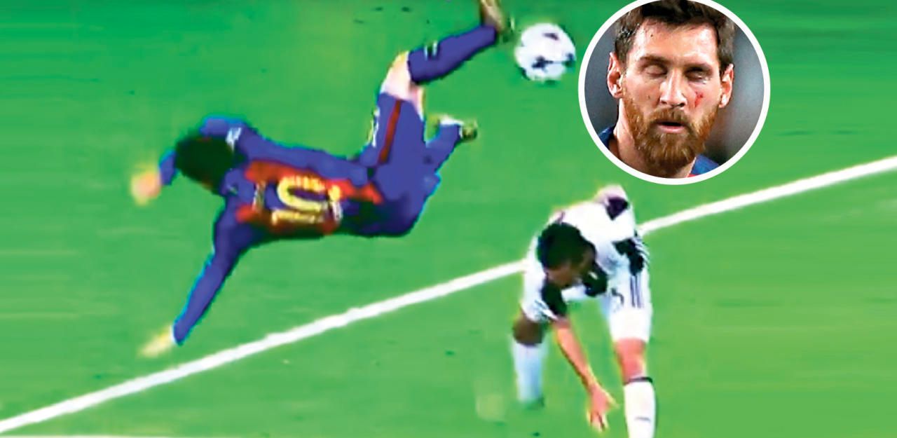 Sport – Hier holt sich Lionel Messi ein blutiges Cut | Heute.at