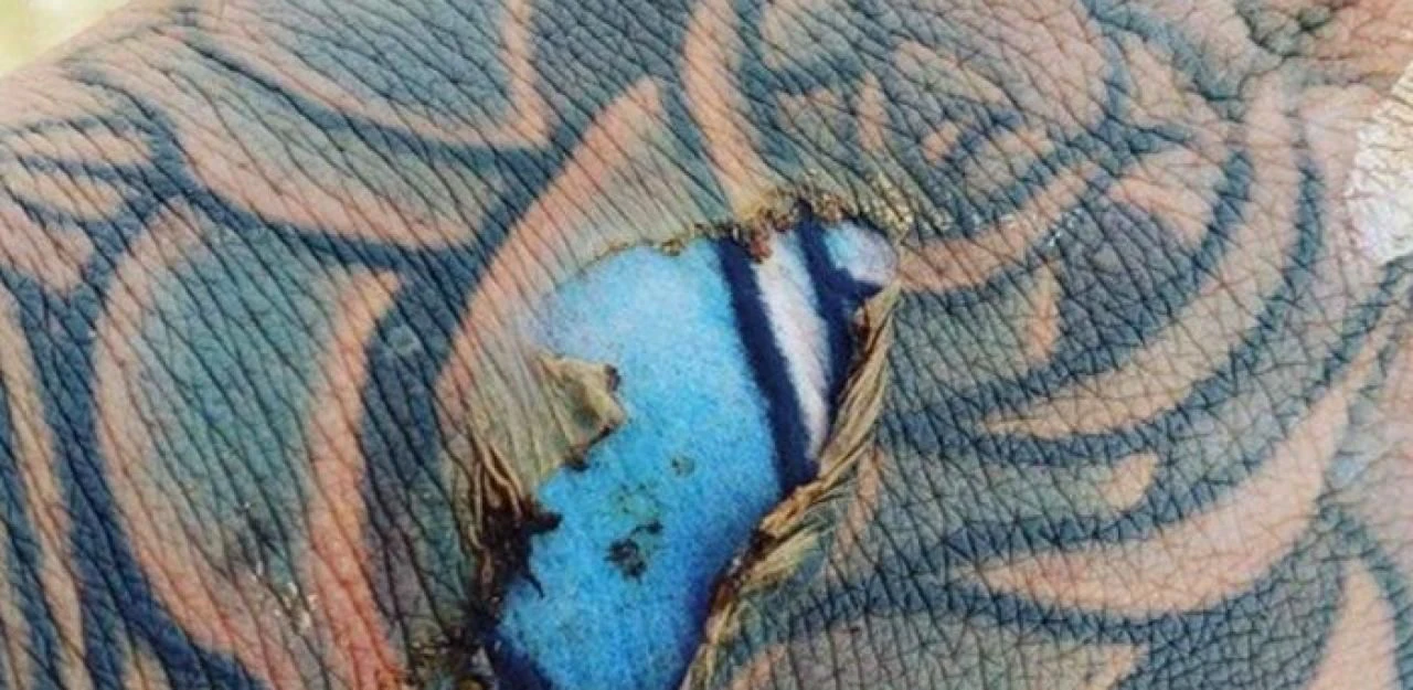 Dieses Tattoo sieht nach Verbrennung wie neu aus | Heute.at