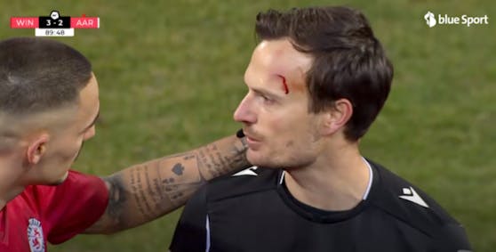 Wie in Graz – Schiri-Blut nach Becherwurf von Fan - Fussball | heute.at