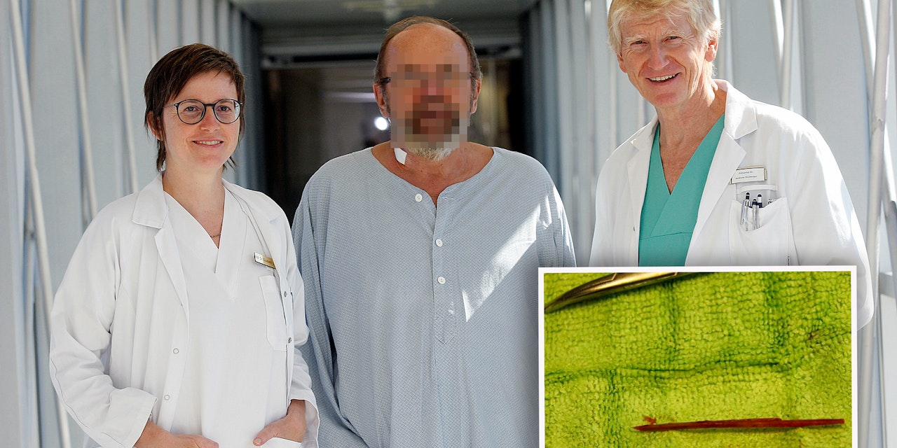 Österreich-News – Mann verschluckt Zahnstocher im Cordon Bleu – Not-OP ...