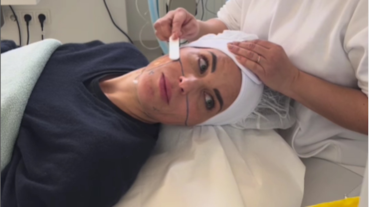 Autsch! – Ö3-Star Elke Rock: "Ich gönn' mir ein Facelifting" | Heute.at