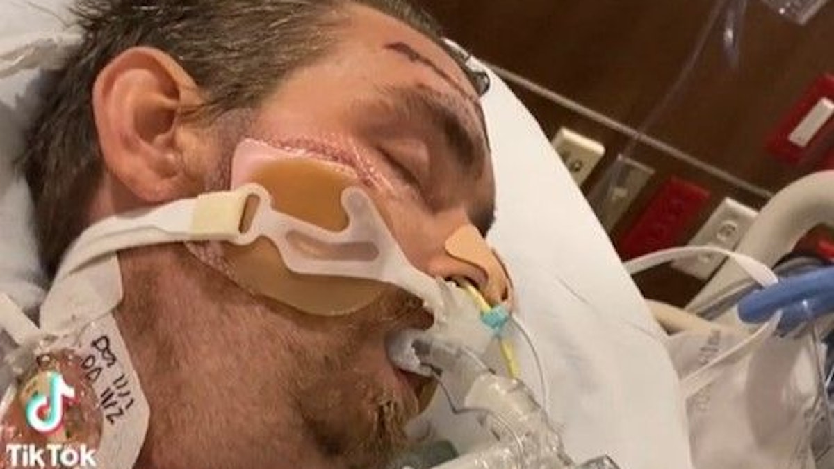 Nur 4 Prozent Überlebenschance – Eingewachsenes Haar kostet Mann fast ...