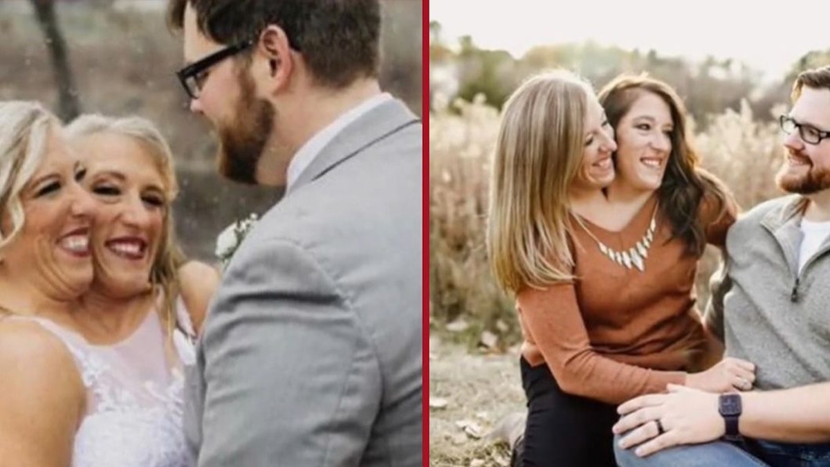 USA – Flotter Dreier – Siamesische Zwillinge haben geheiratet | Heute.at
