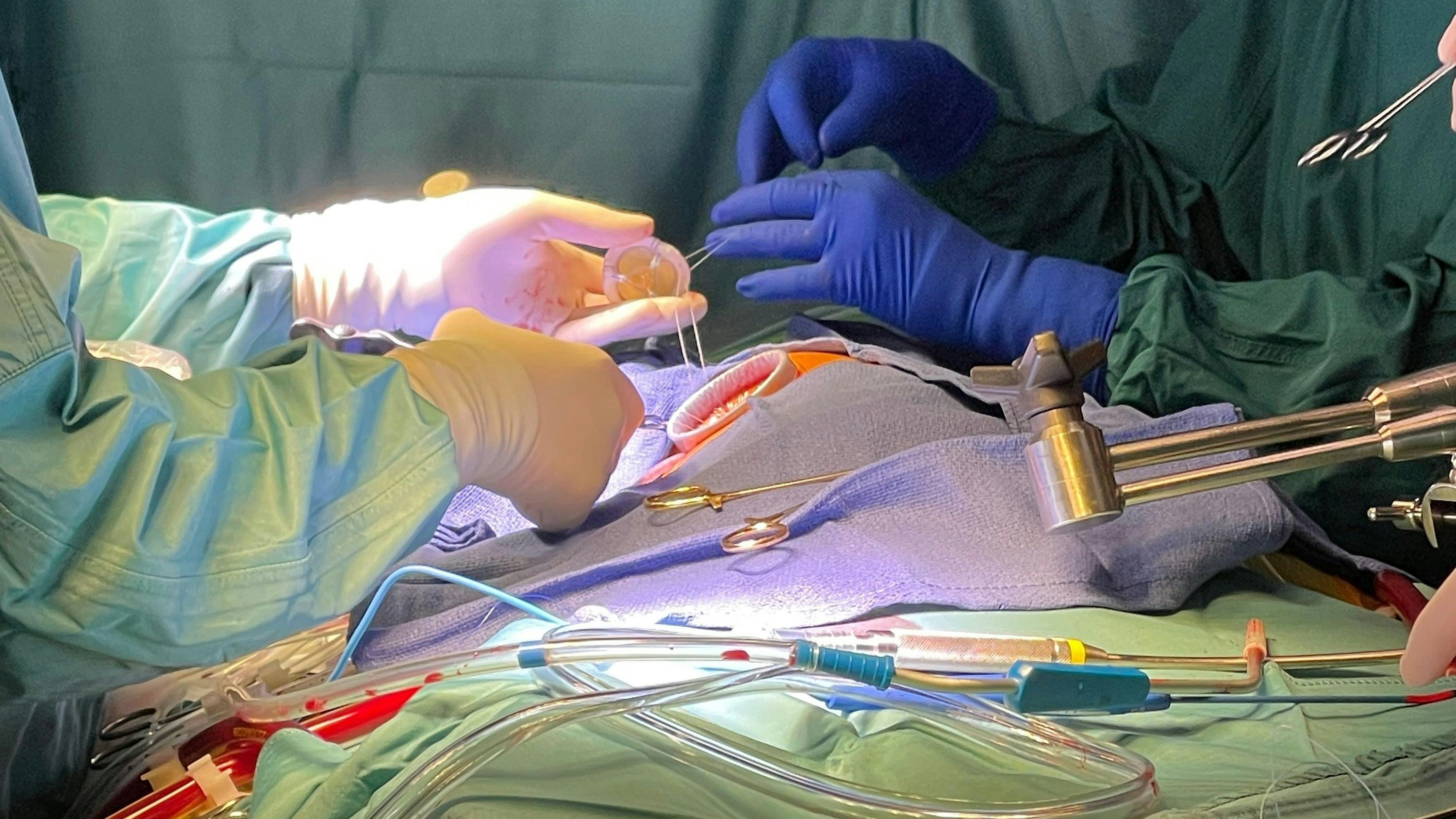 Trikuspidalklappe OP AKH 2024 | Heute.at