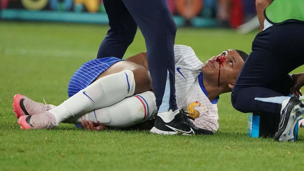 Hitziges EM-Duell – Grob unsportlich! Blut-Mbappe regt mit Sitz-Streik ...