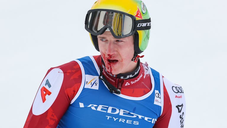 Flug nach Sun Valley – Haaser will wenige Tage nach Blut-Crash wieder ...