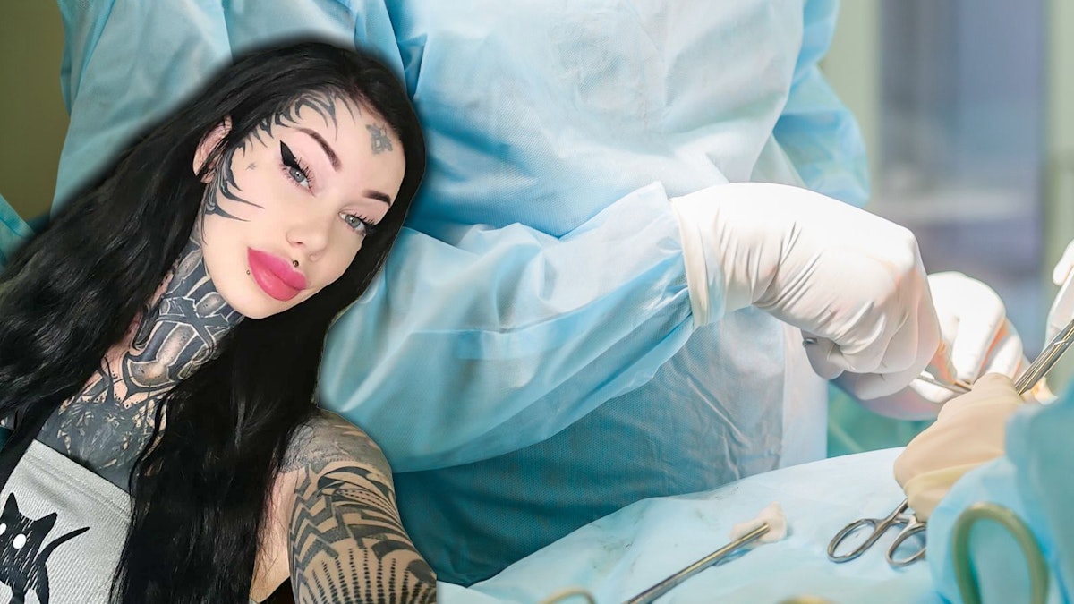 "Flüssigkeit rausgeplatzt" – Wienerin (26) erlebt nach Brust-OP in Prag ...